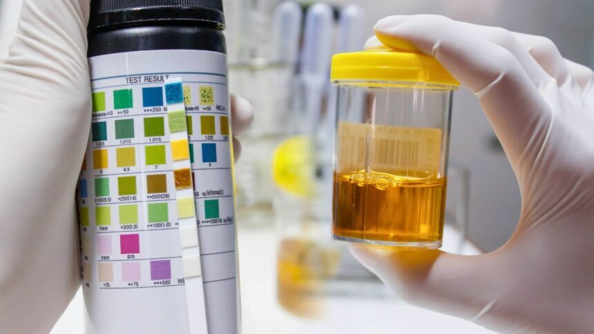 These 7 Different Colors Of Urine Tell About Your Health